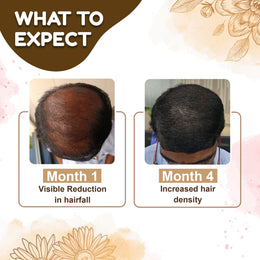 The Classic Hair Growth Kit | Nonu Care – Nonucare